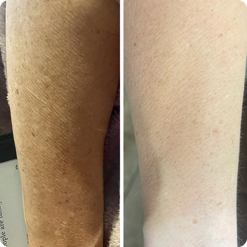 Arm Firming Cream - Fountain